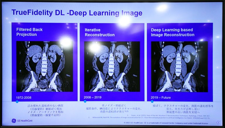 GEヘルスケア最新 AI CT「Revolution Ascend Elite」発売_True Enhance DL 新搭載、日本主導で開発し ...